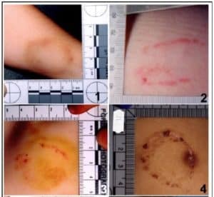 Forensic Odontology | SchoolWorkHelper